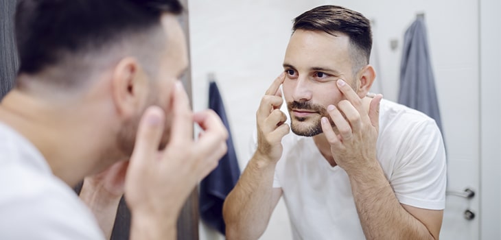 Ojeras moradas: causas y soluciones - Alma Médica