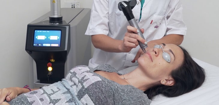 Alma-Q, el láser la opción de las celebrities - Alma Médica