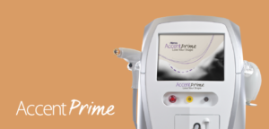 Diferencias entre Alma Primex, Accent Prime y Opus