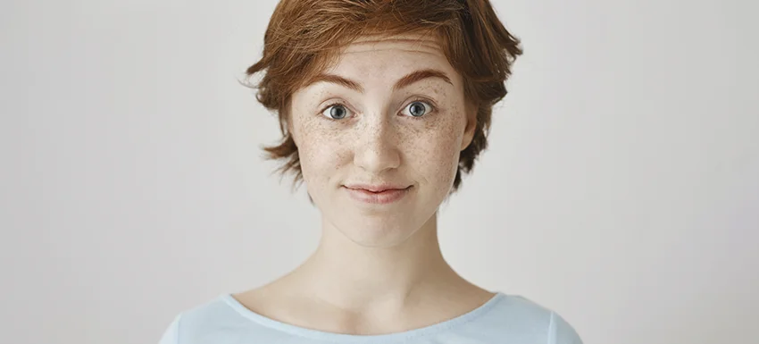 Cómo quitar pecas: trucos, cuidados y prevención