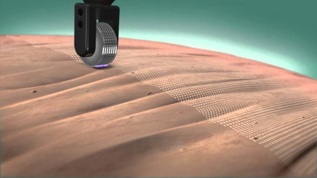 Tecnología microplasma Alma|Equipo radiofrecuencia fraccionada